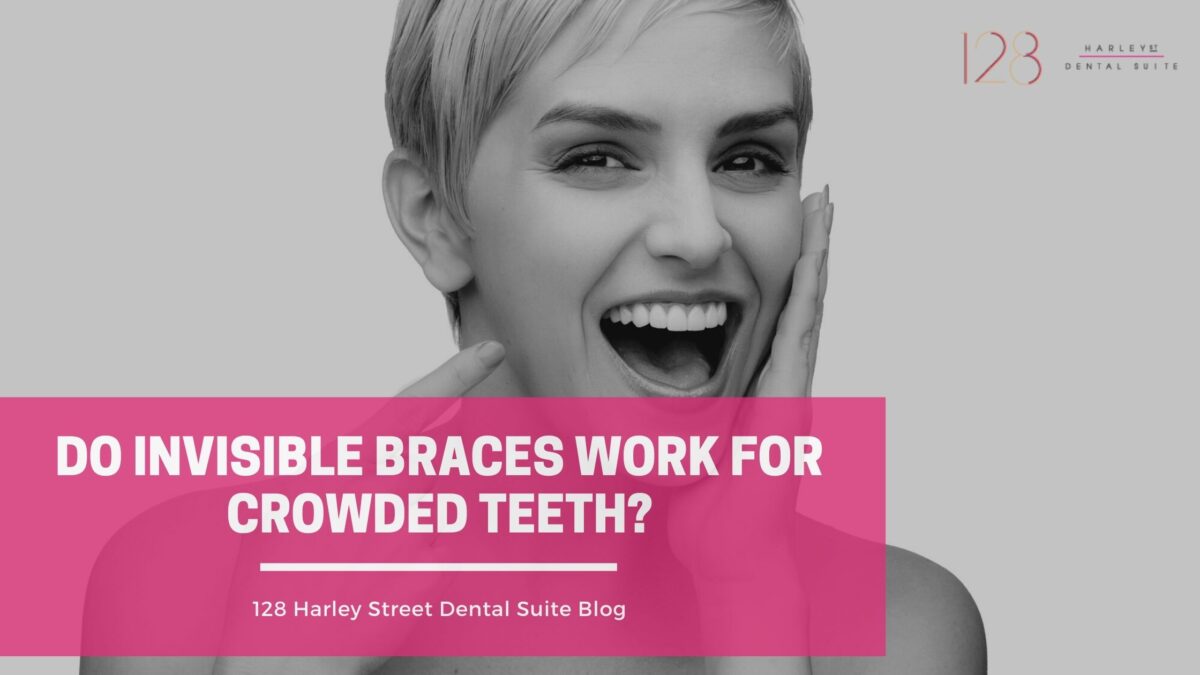Do Invisible Braces Work for Crowded Teeth? | 128 Harley Street Dental